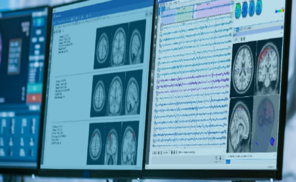 BrainView & VitalScan in Brownsville, TX | MAOB